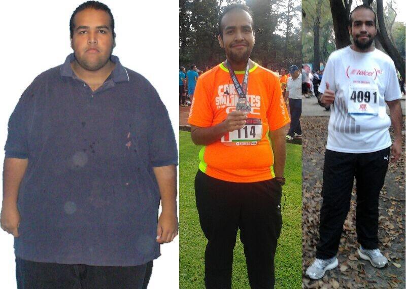 Le fléau de l’obésité au Mexique