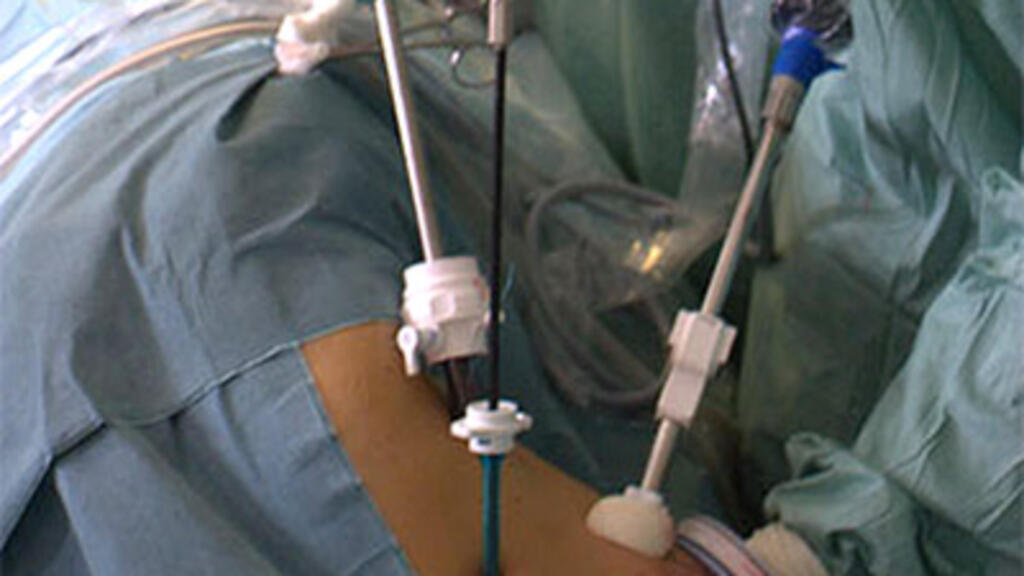 2. Le rein - Priorité santé