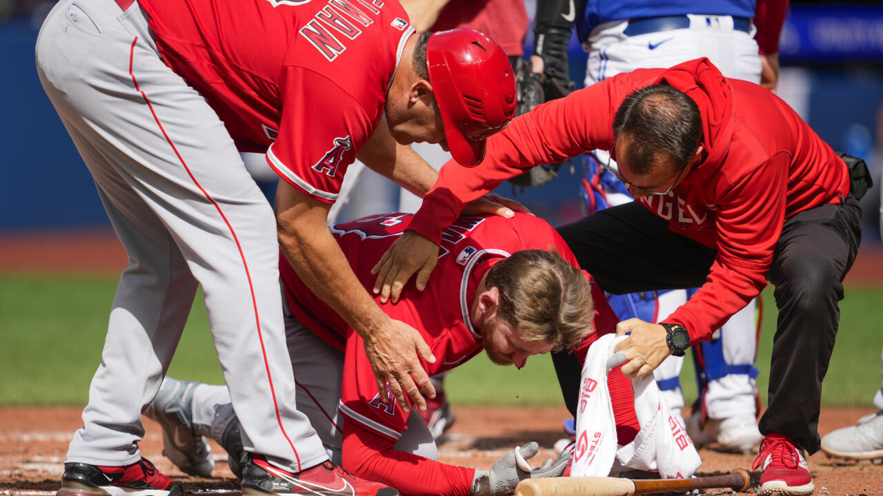 Angels' Ward has facial fractures after hit by pitch