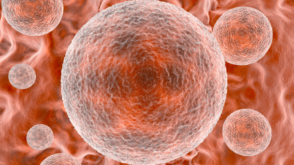 Le trachome: principale cause de cécité d’origine infectieuse dans le ...