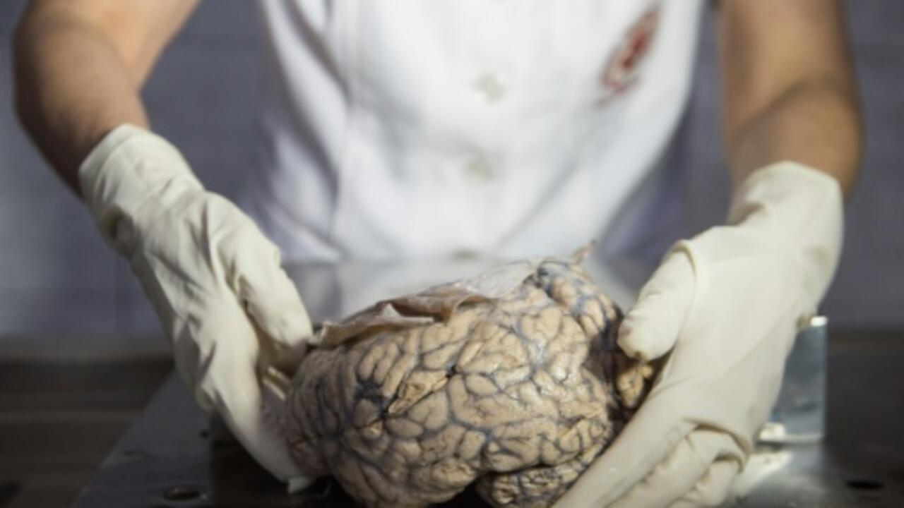 Study reveals microplastics can enter human brain through nasal pathway