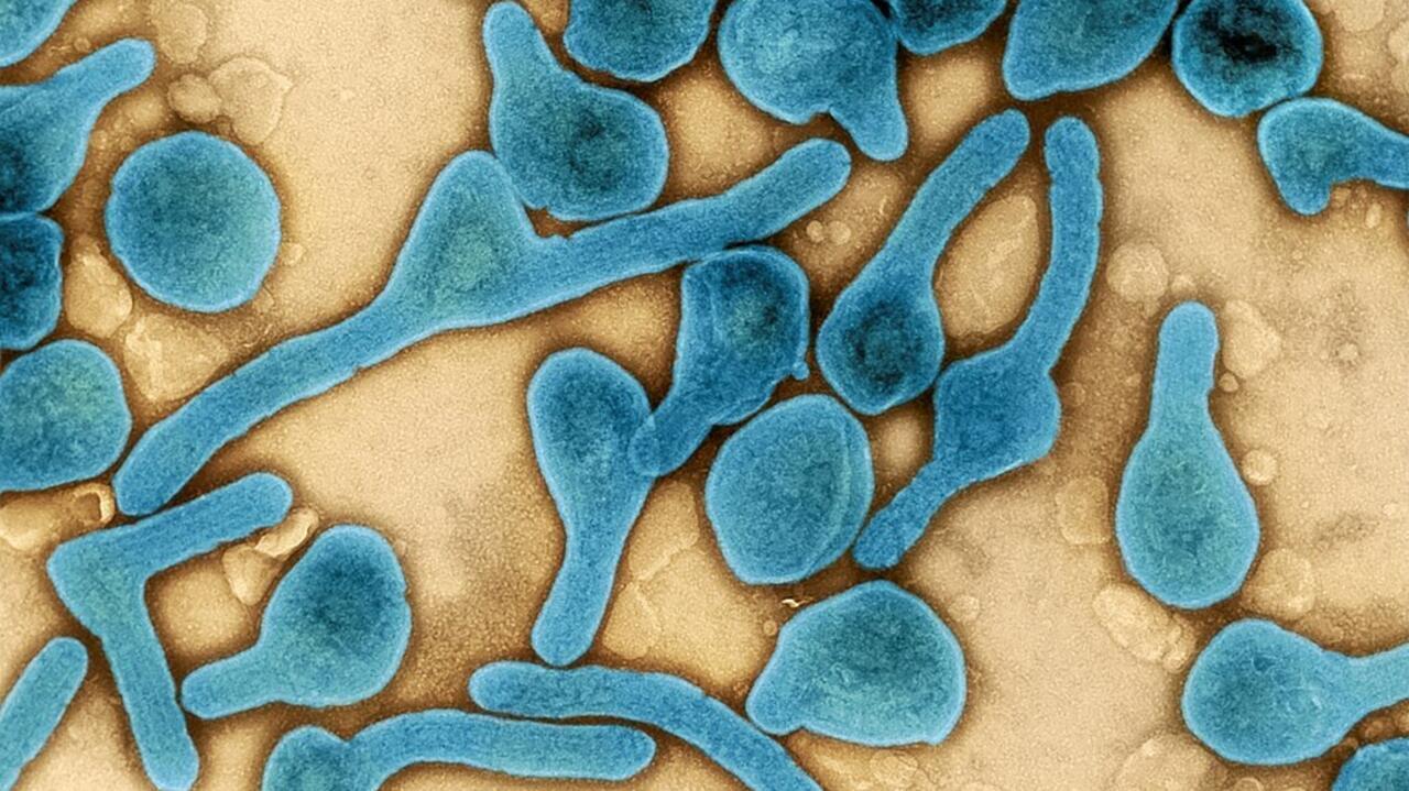 Tanzania: Watu wanane wafariki kutokana na ugonjwa unaoaminiwa kuwa ...