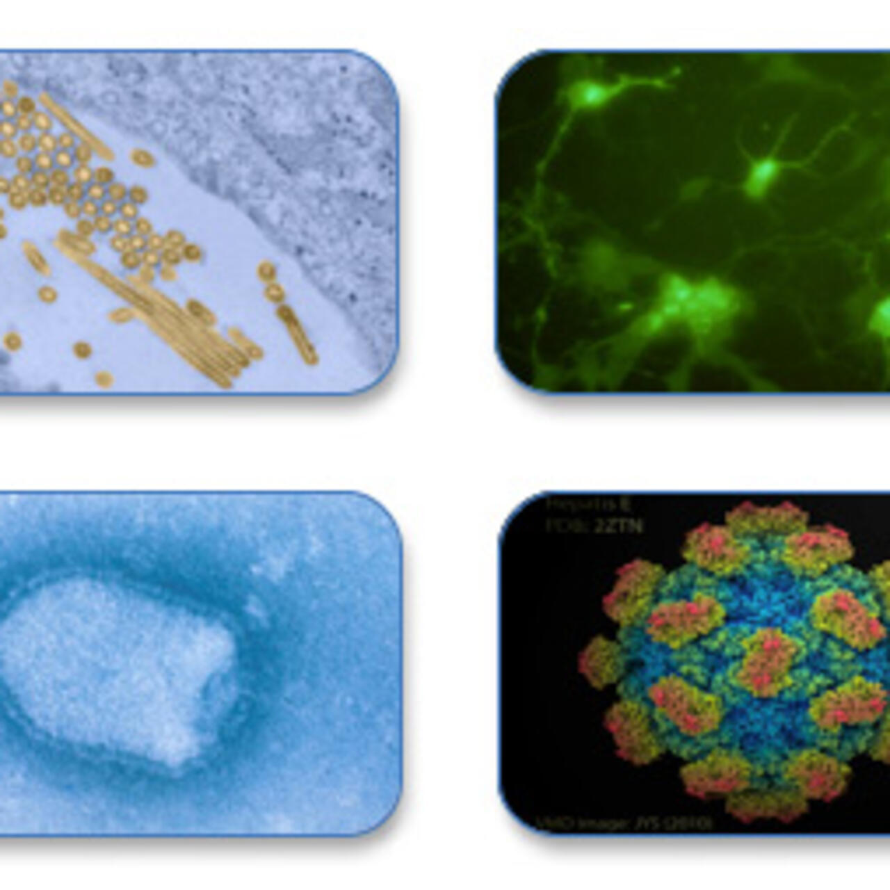 Cellule Du Virus De La Rage Rage : Un Virus Pour Explorer Le Cerveau
