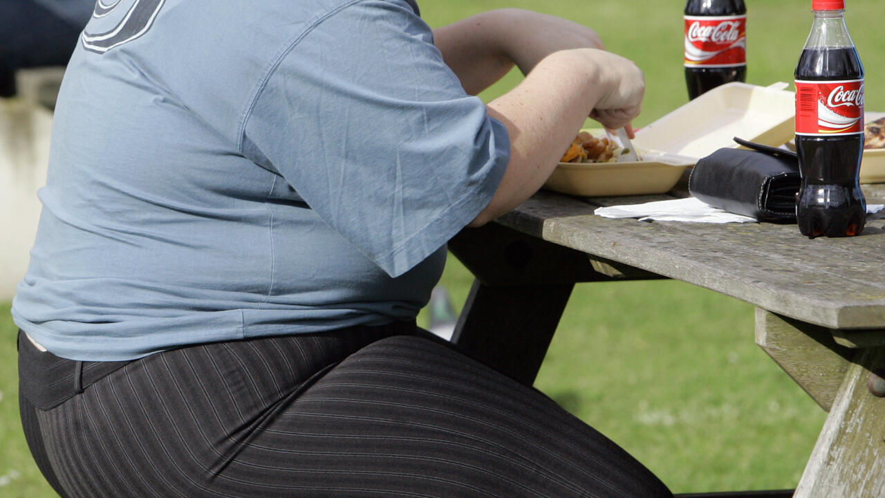 More that 1 billion of world's population is clinically obese, study shows