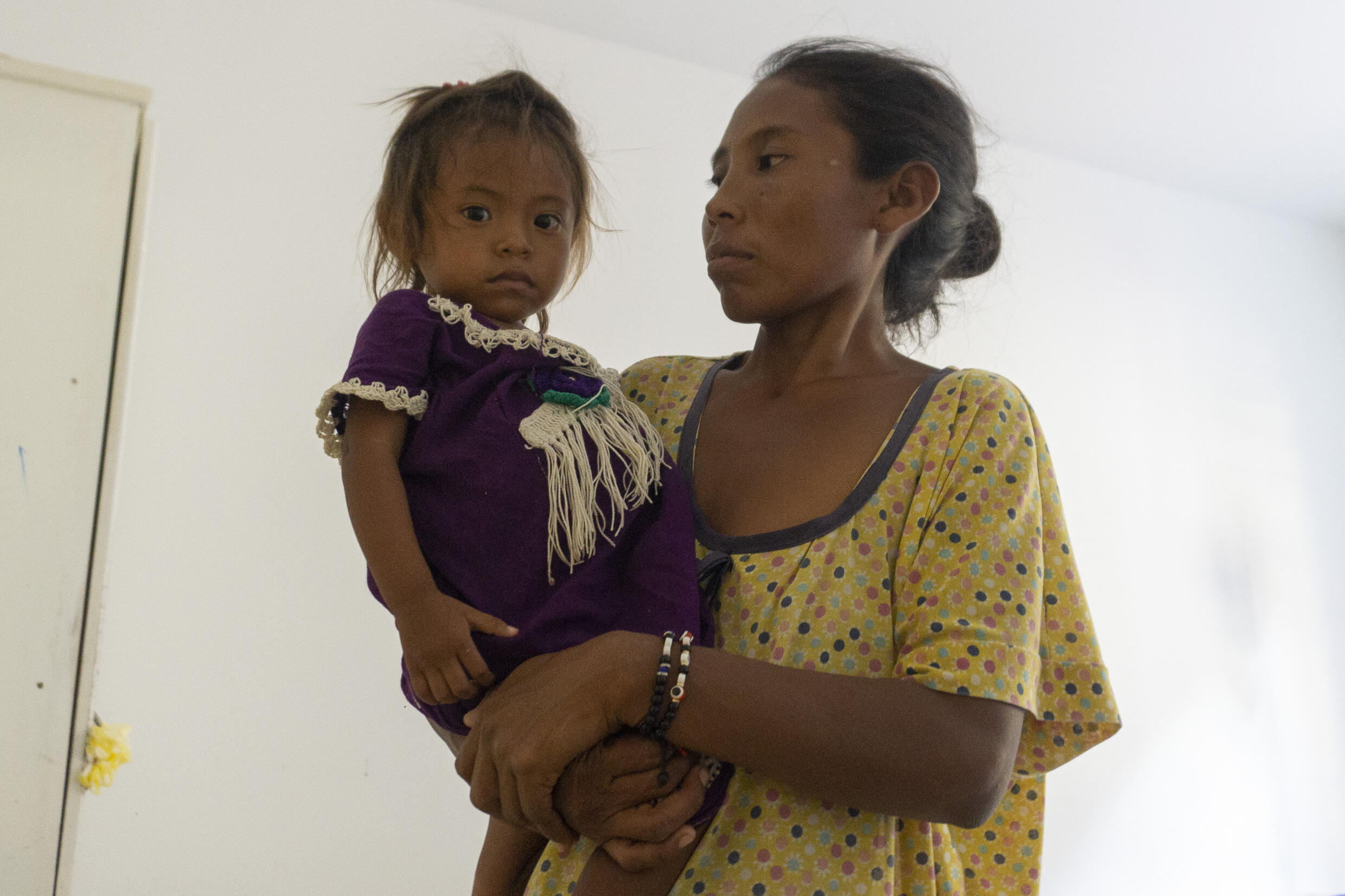 Hunger, thirst stunting Indigenous children in Colombian desert