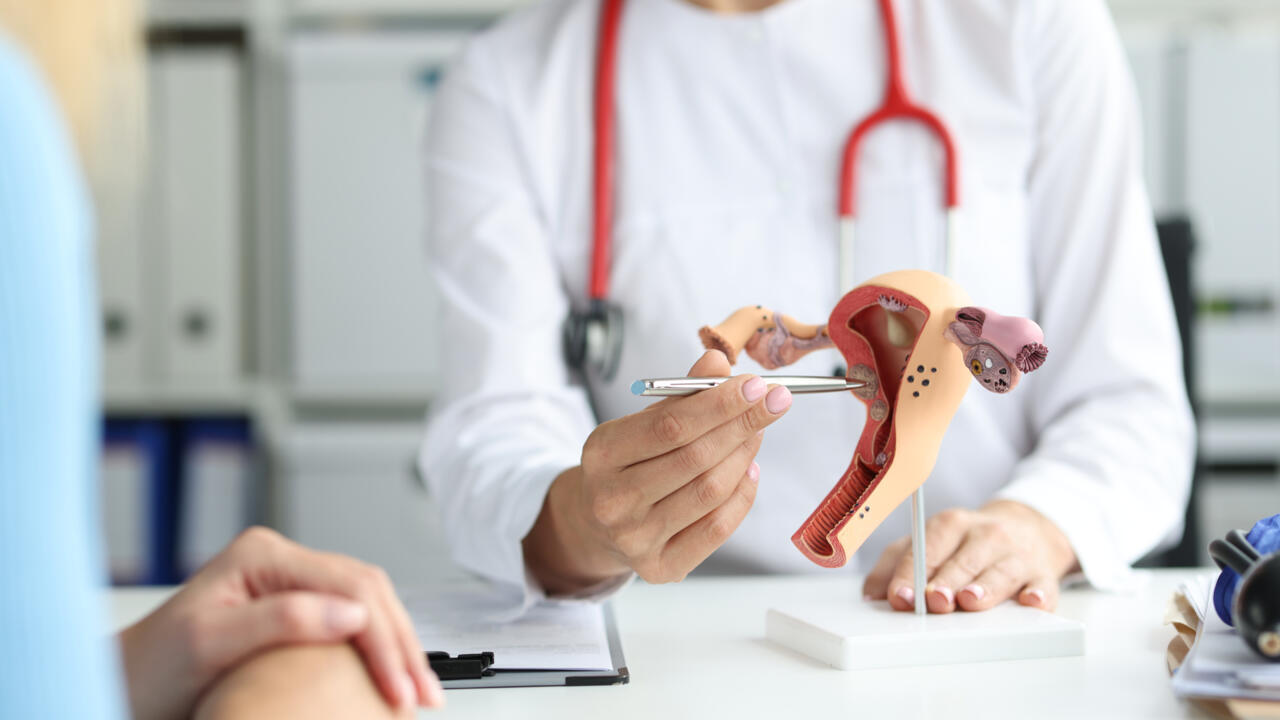 Fibromes utérins : dans quels cas nécessitent-ils un traitement ? - Le ...