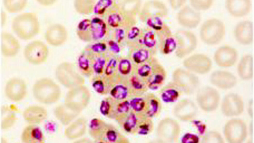 Le parasite du paludisme «vivax» touche des populations jusqu'ici ...