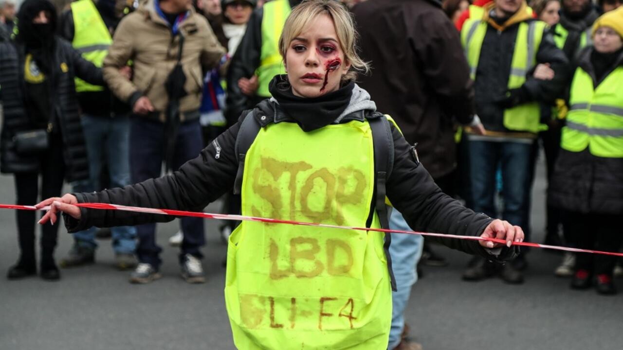 Глава МВД Франции объявил о прекращении использования гранаты на митингах