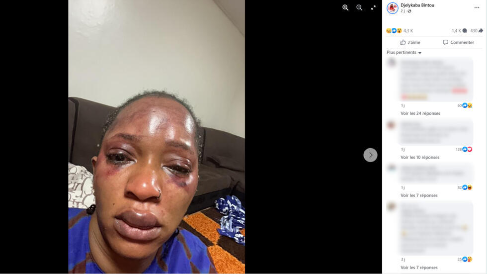 Guinée: la chanteuse Djelykaba Bintou victime des violences conjugales, l’affaire suscite l ...