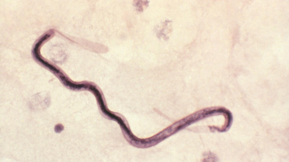 Un Smartphone anti-Loa loa - Un monde de tech