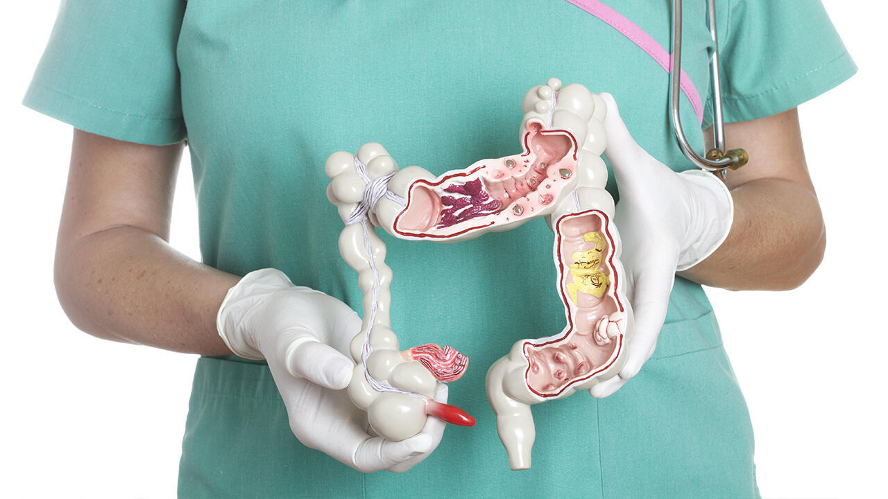 Appendicite et péritonite - Priorité santé