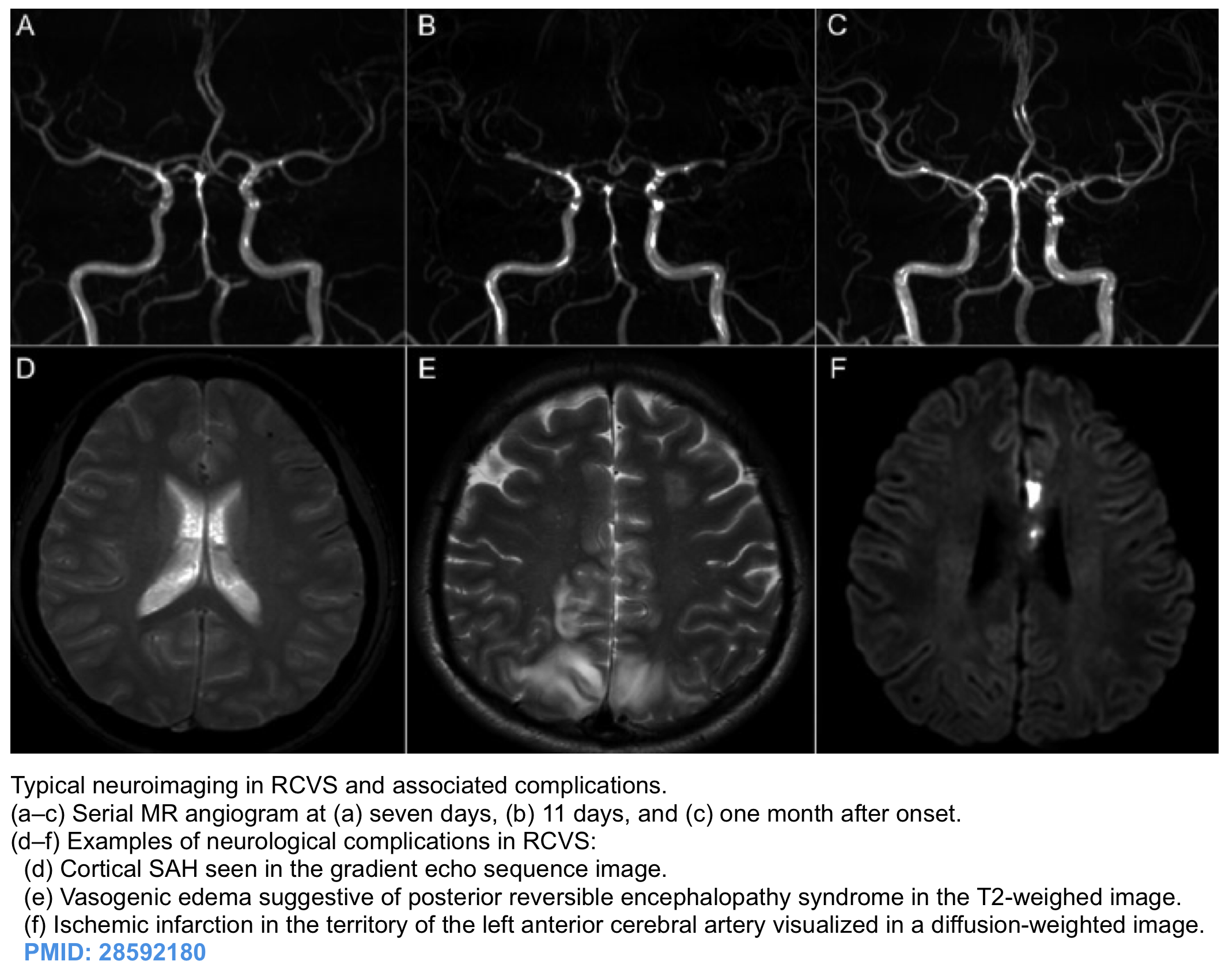 Французькі медики проти спреїв від нежитю та ліків від застуди. Що ...