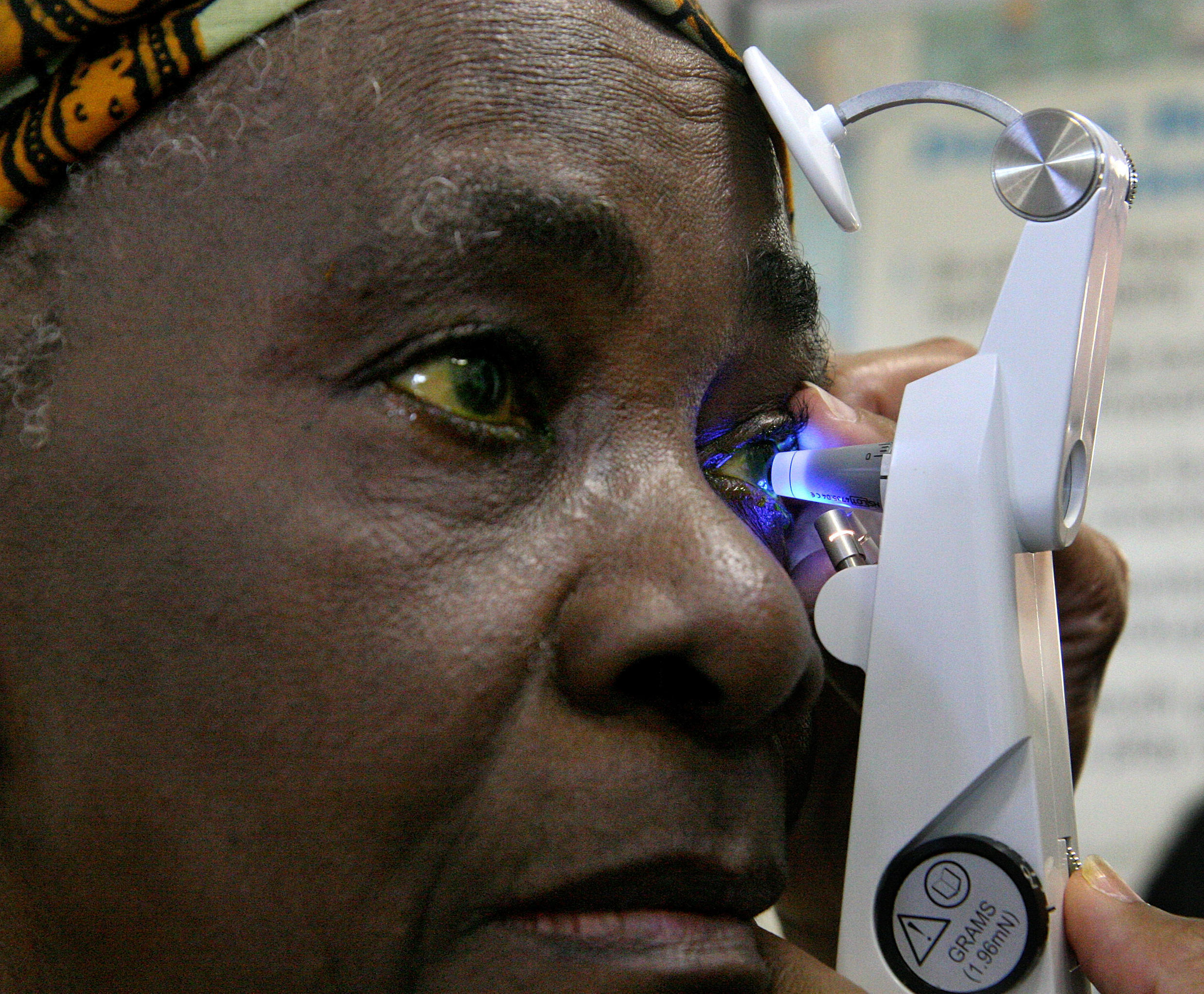 Semaine mondiale du glaucome pour sensibiliser contre cette maladie ...