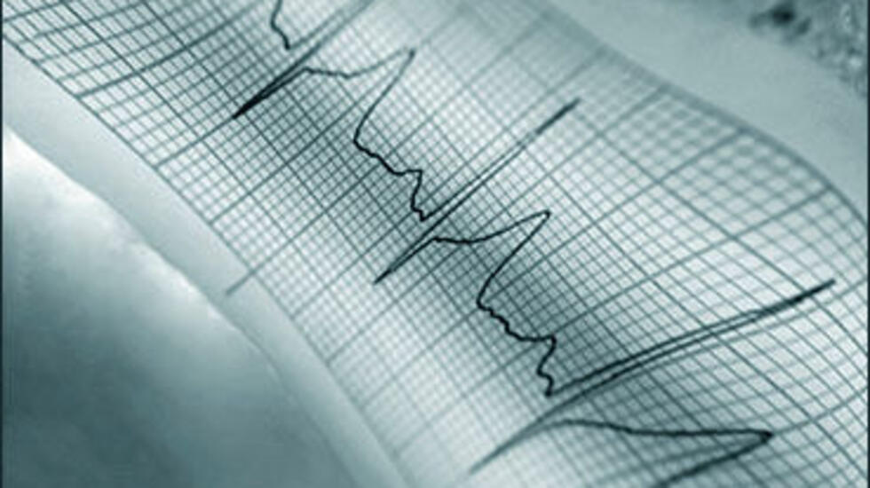 1. Les troubles du rythme cardiaque - Priorité santé