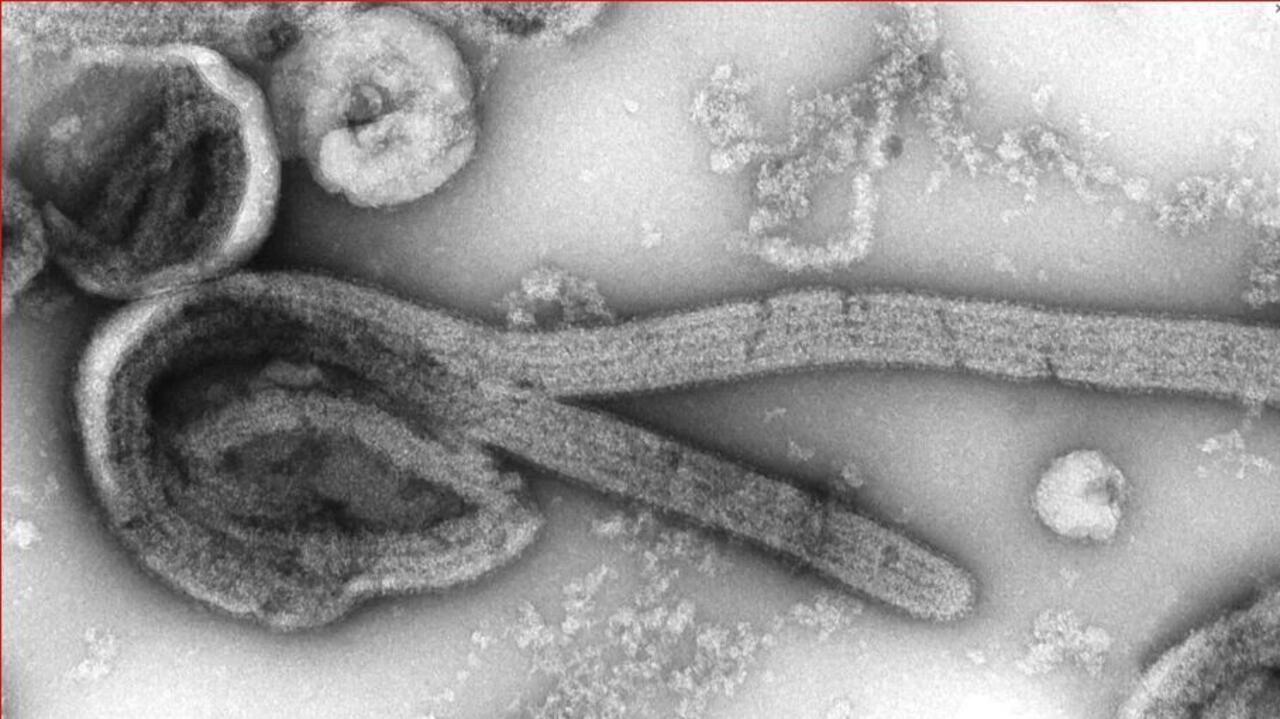 Ethiopia confirms outbreak of deadly Marburg virus: Africa CDC - RFI