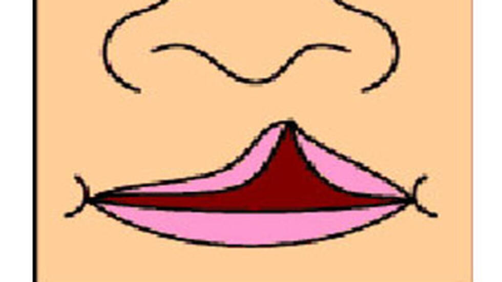 Chirurgie réparatrice: le salut des personnes sujettes aux becs de ...