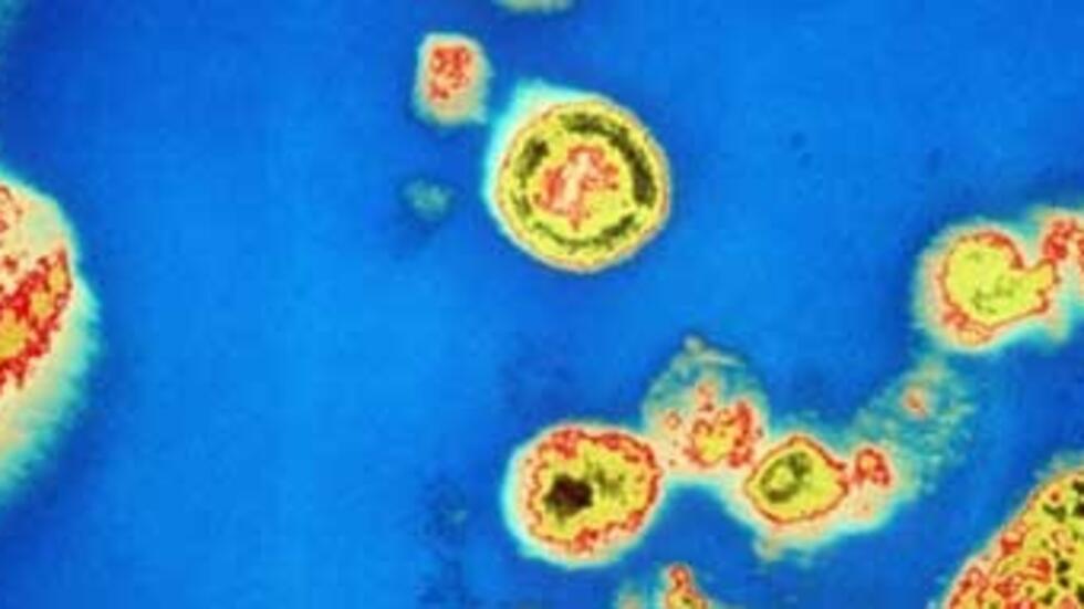 Congrès mondial sur le Sida: où en sont les chercheurs?