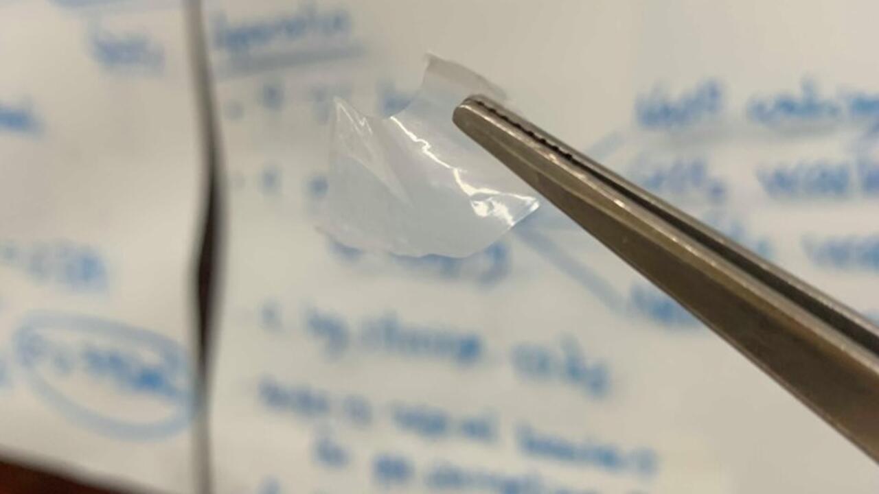 Young scientist creates bio-plastic from mango peels and seaweed - RFI