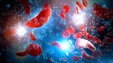 Drépanocytose: comment la prise en charge des enfants se déroule-t-elle ...