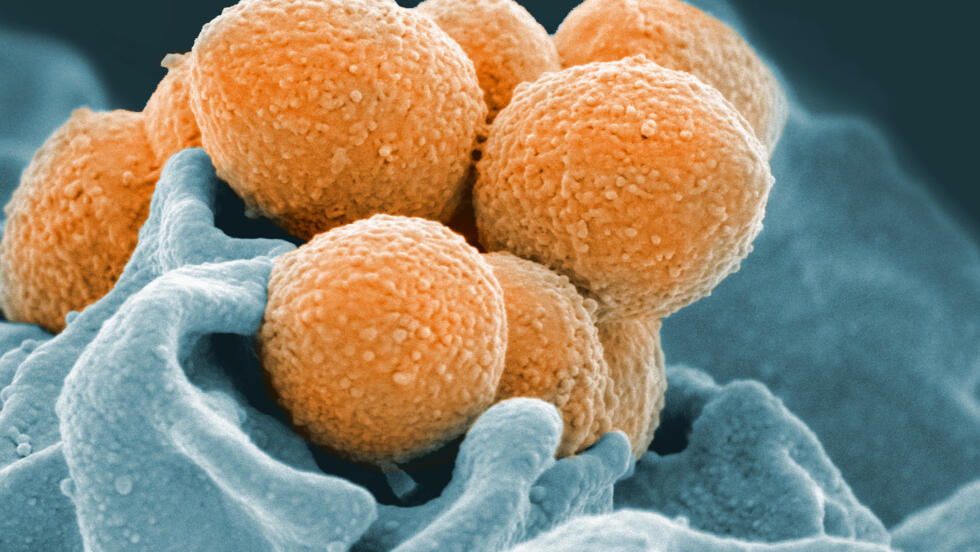 France: une recrudescence d'infections graves à streptocoque A qui pose ...
