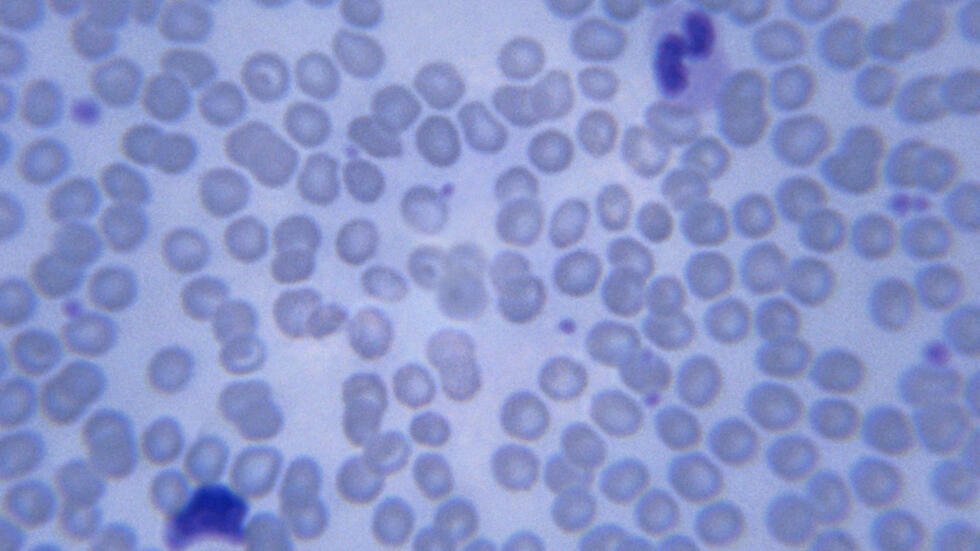 Téléthon 2013: l'appel aux dons pour la recherche sur les maladies ...