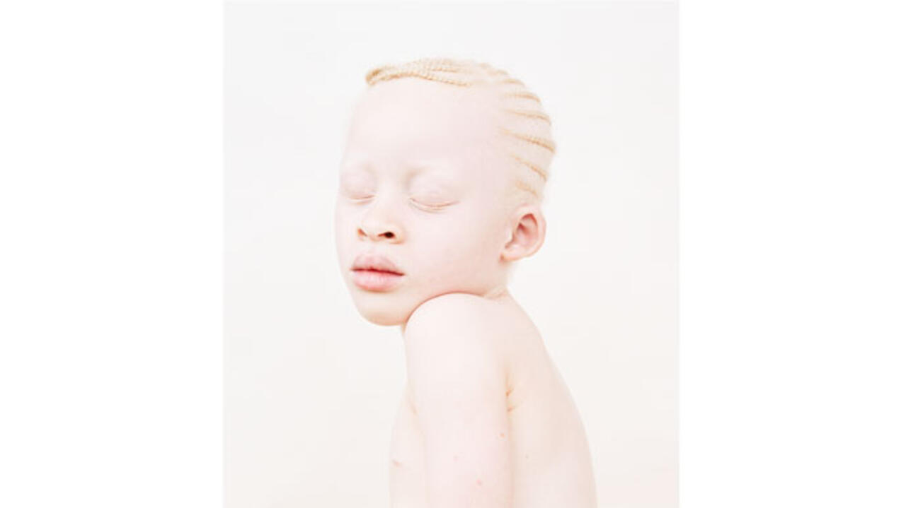 1. Eric Nehr : portraits des albinos en Afrique - Culture vive