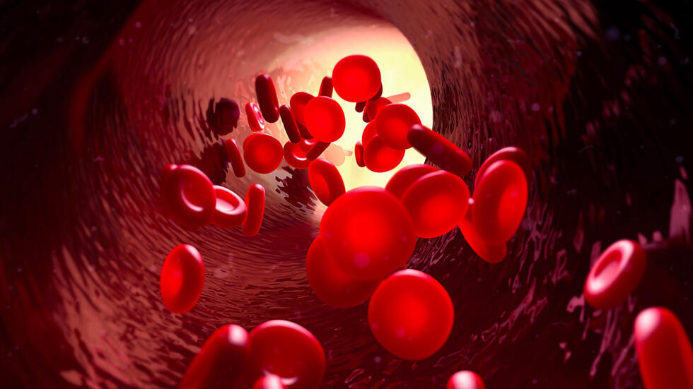 L'anémie : premier signe de la drépanocytose - Le conseil santé